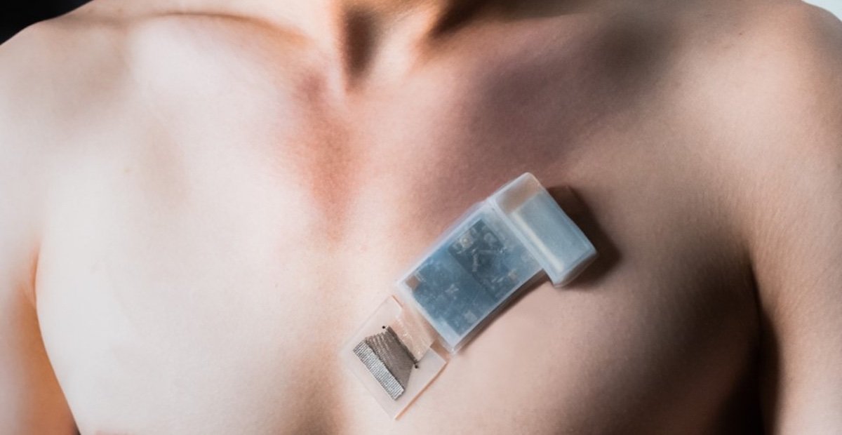 Integrated Systems for Deep Tissue Monitoring | Nanodigest